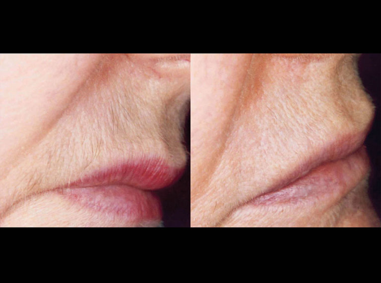 Icon Aesthetic System | Innovative Dermatology | Greenville Delaware ...