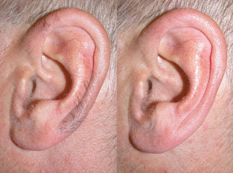 Icon Aesthetic System | Innovative Dermatology | Greenville Delaware ...